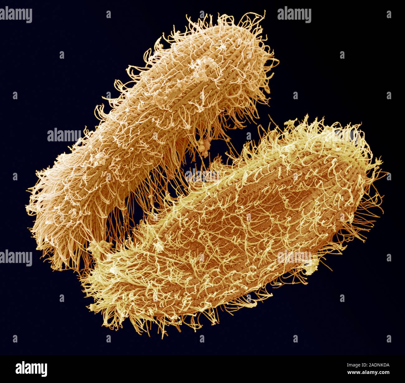 Ciliate protozoa. Coloured scanning electron micrograph (SEM) of ...