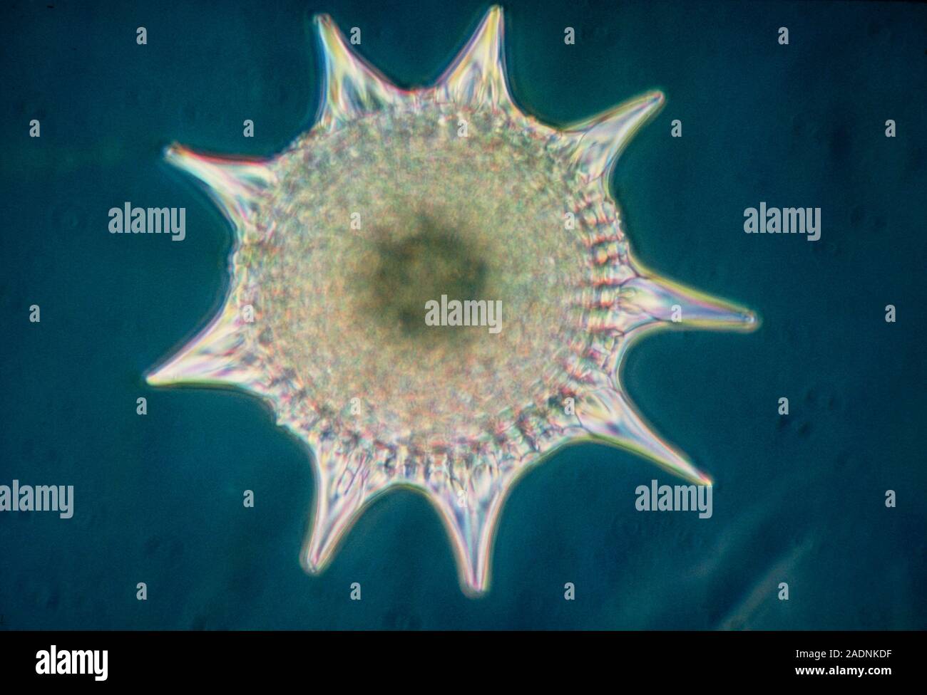 Radiolarian protozoan. Light micrograph of a radiolarian Heliodiscus sp., a type of shelled ...
