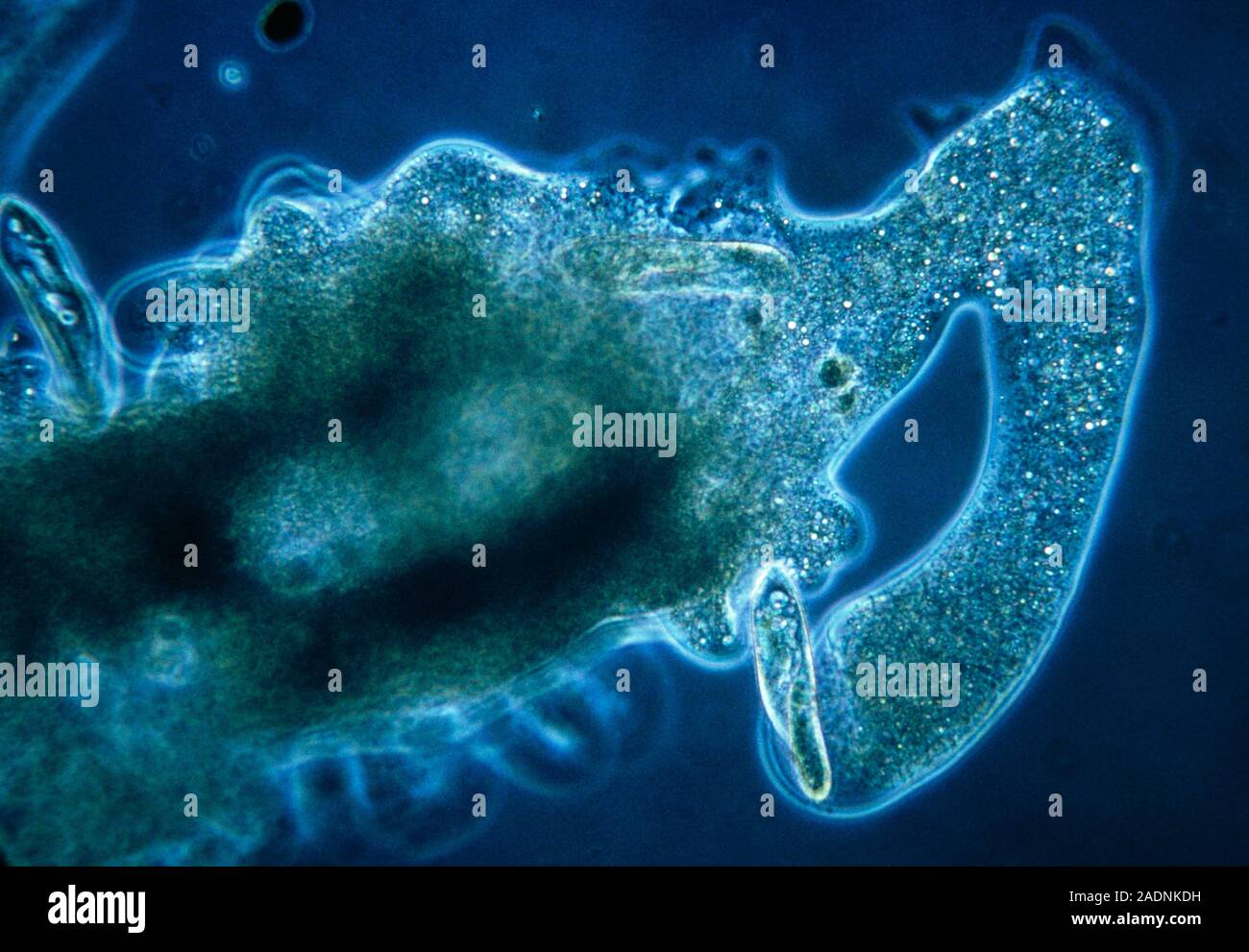 Amoeba protozoan feeding. Third in a series of four light micrographs ...