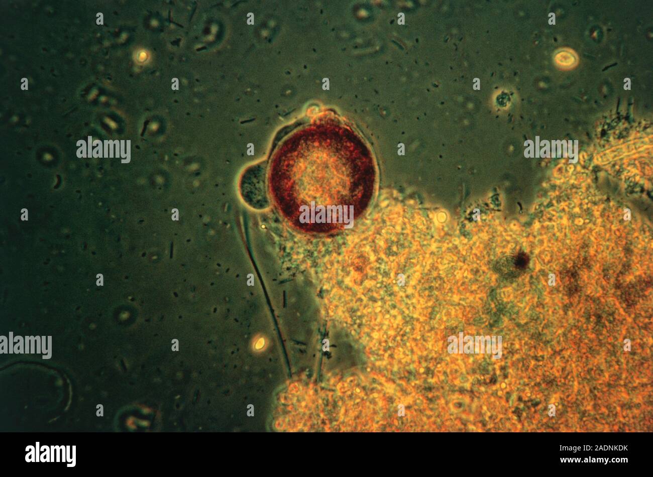 Shelled protozoan amoeba. Light micrograph of a shelled amoeba ...