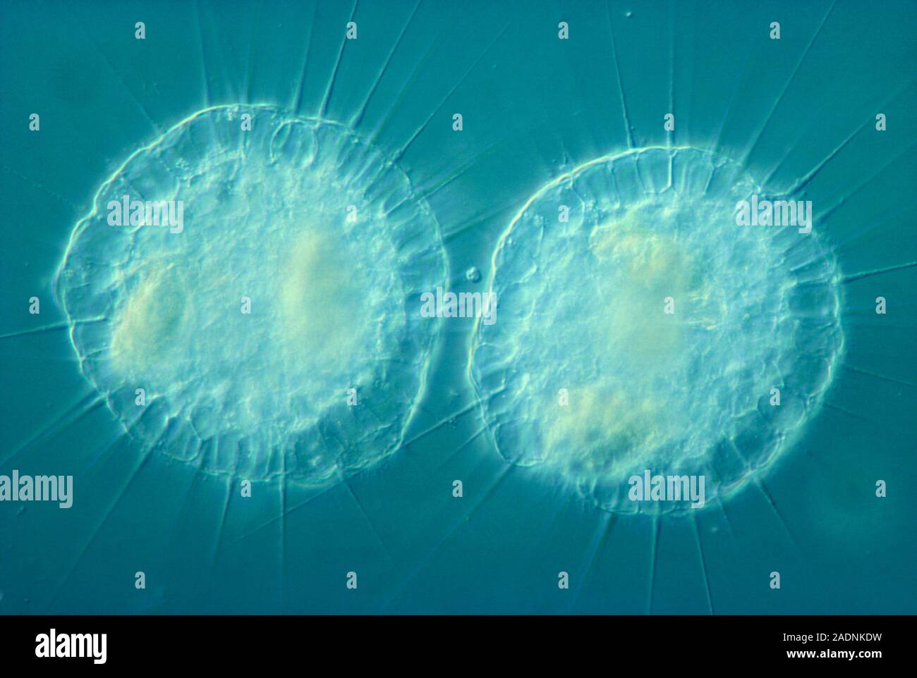Light micrograph of the protozoa Echinosphaerium sp., a Heliozoan ...