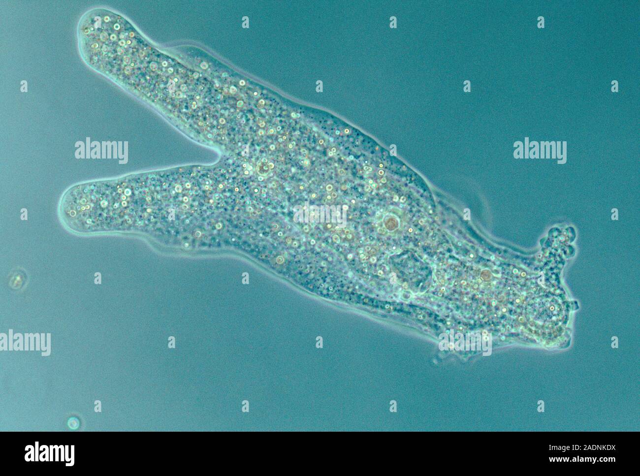 Light micrograph of the protozoan, Amoeba proteus. Magnification: x146 at 35mm size Stock Photo ...