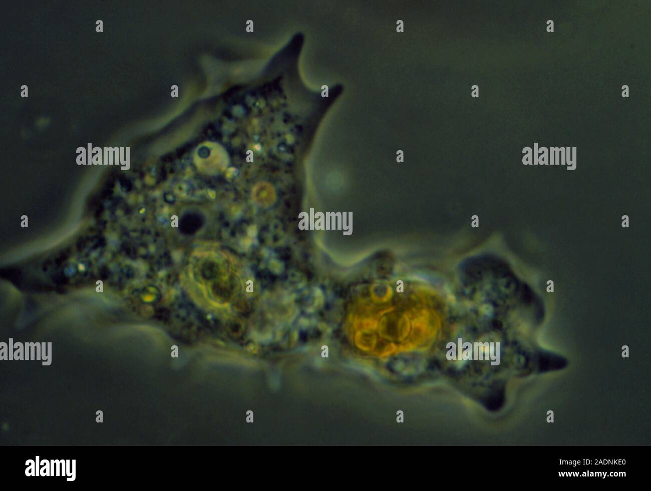 Light micrograph of a freshwater amoeba showing several food vacuoles contained within the cell ...