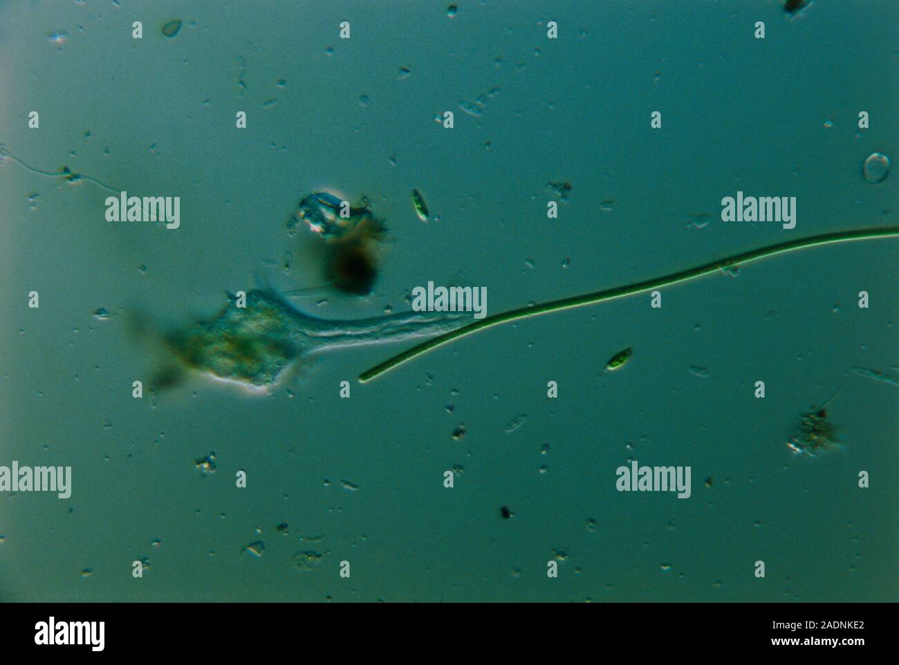 Light micrograph (Nomarski) of Amoeba sp (0. 2- 0. 5mm in diametre ...