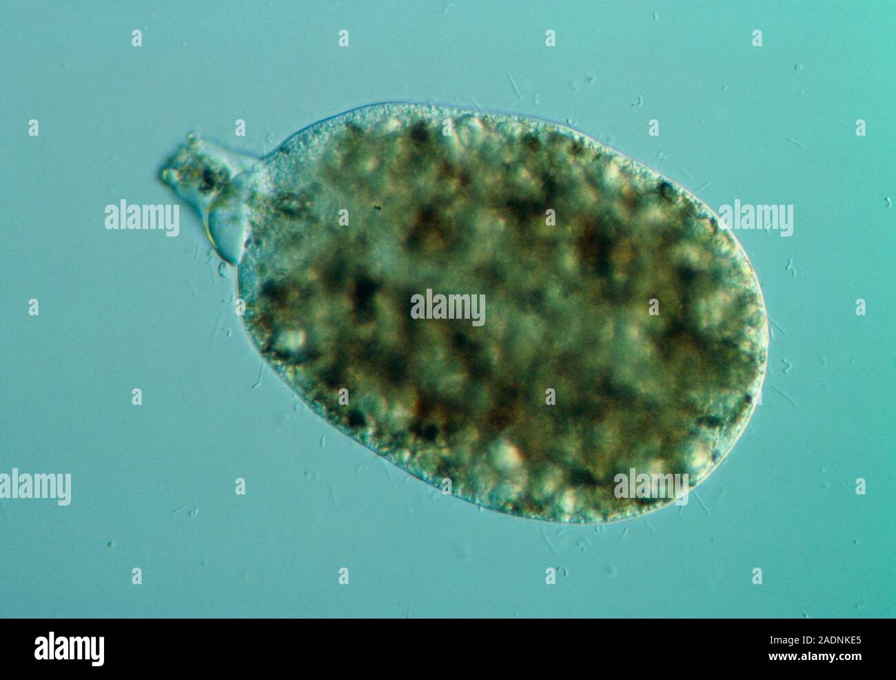Light micrograph of the large, shell-less amoeba Pelomyxa sp., a common ...