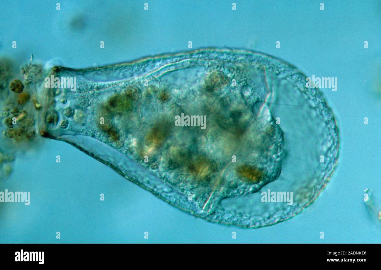 Light micrograph of the testate (shelled) amoeba Nebela sp., a common ...