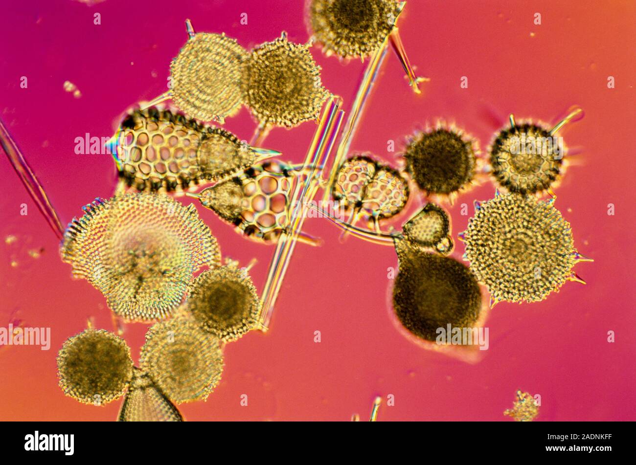Light micrograph of a group of different species of fossil unicellular ...