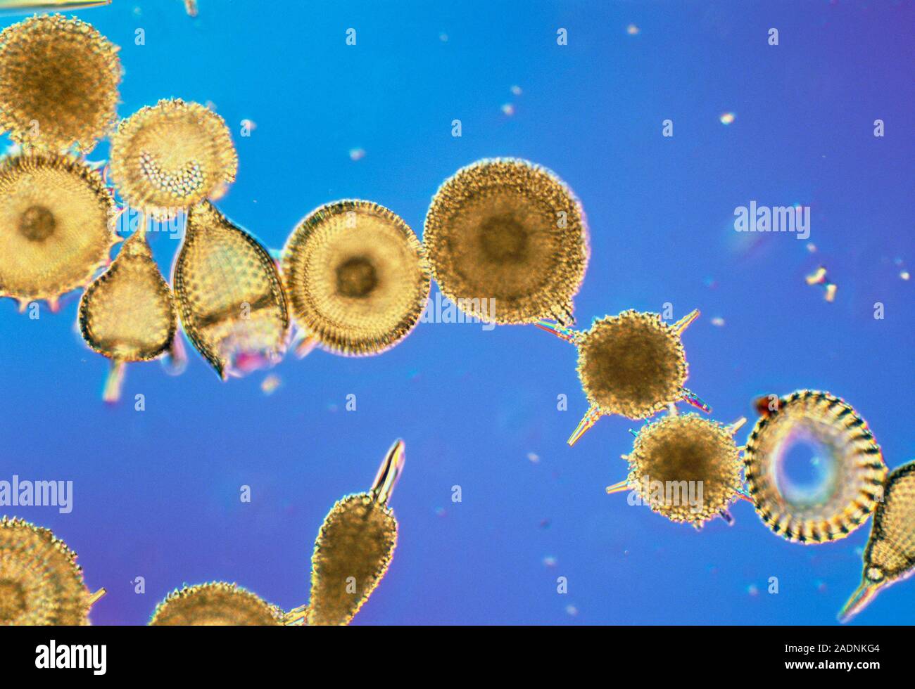 Light micrograph of a group of different species of fossil unicellular ...
