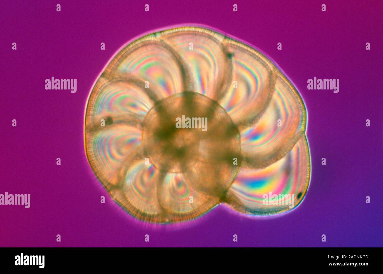 Light micrograph of the foraminiferan, Nonionina depressula. Foraminifera are single-celled ...