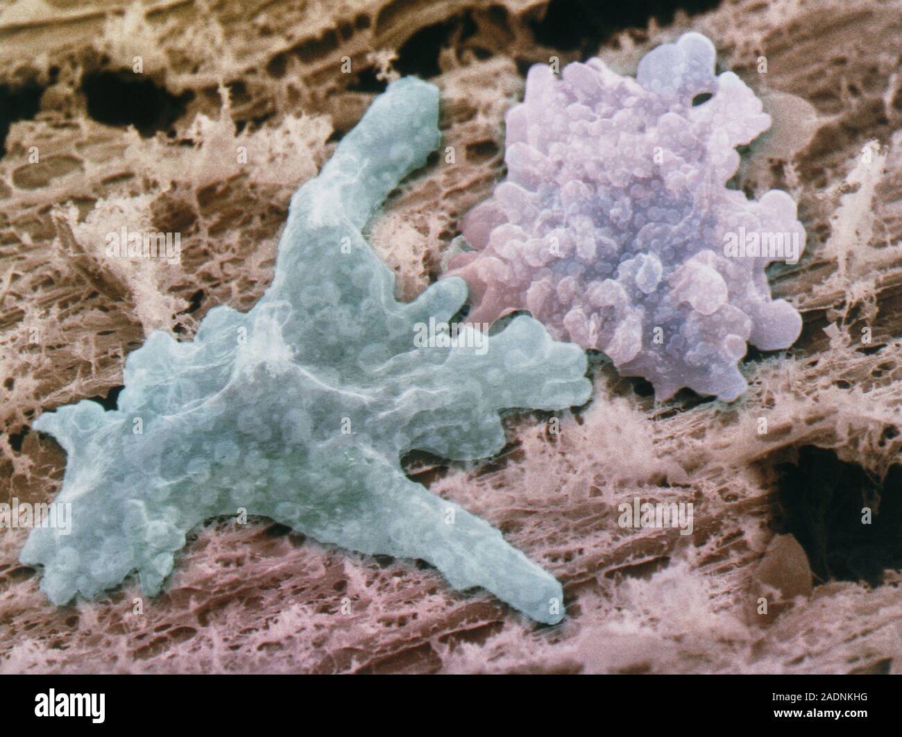 Amoeba feeding. Coloured scanning electron micrograph (SEM) of one ... Amoeba feeding. Coloured scanning electron micrograph (SEM) of one ...
