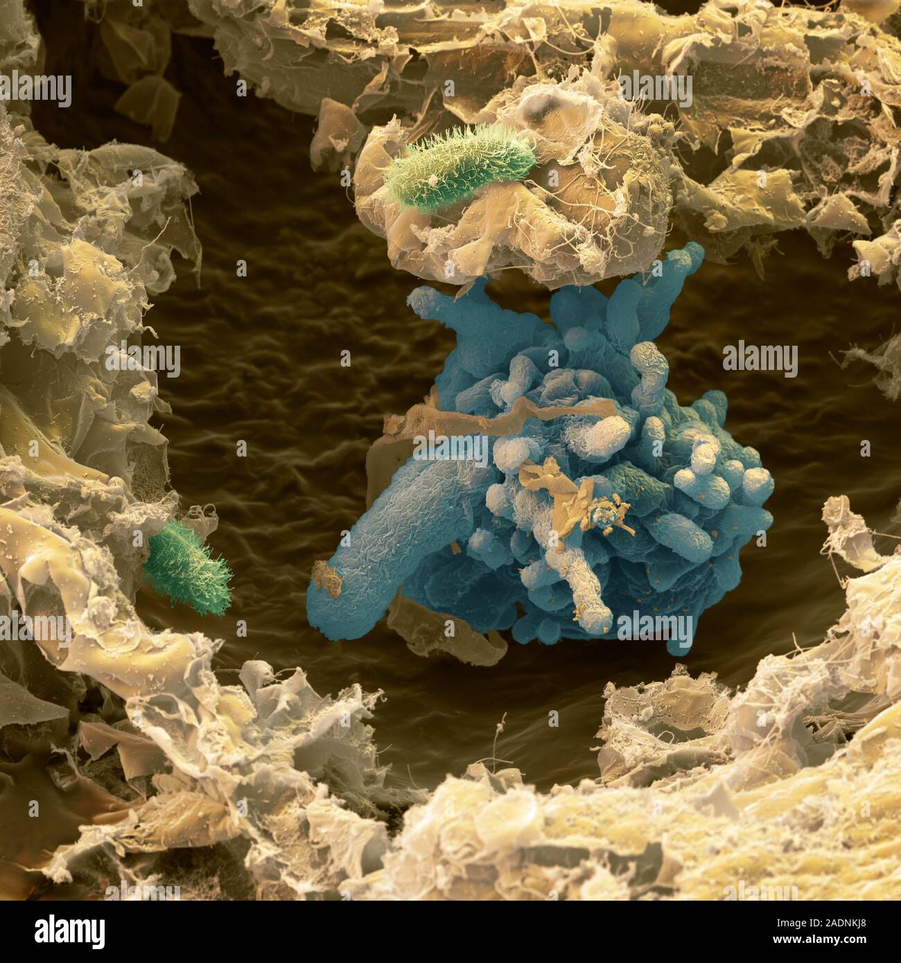Amoeba. Coloured scanning electron micrograph (SEM) of an Amoeba proteus protozoan (blue). This ...