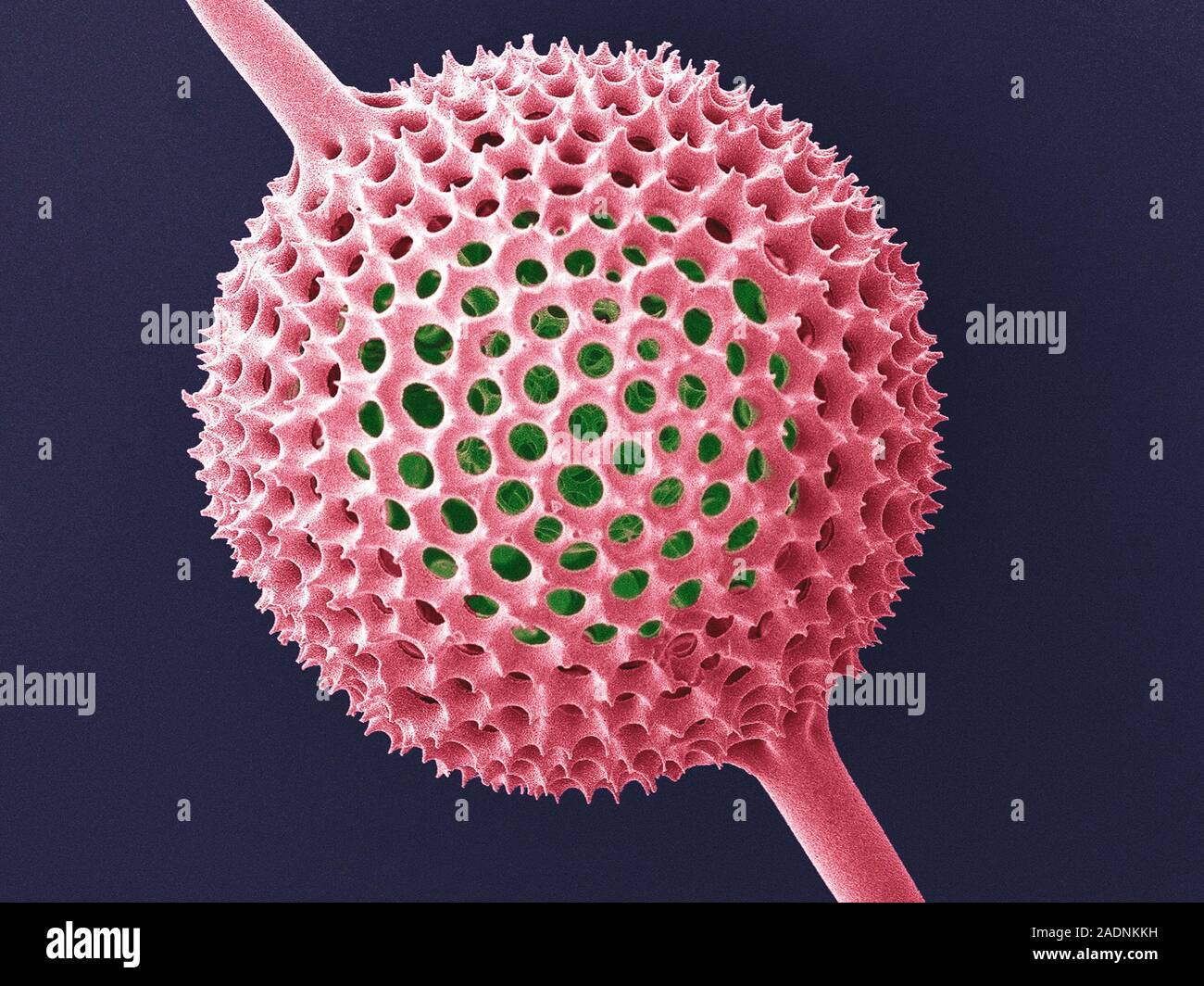 Radiolarian. Coloured scanning electron micrograph (SEM) of the shell of a radiolarian ...
