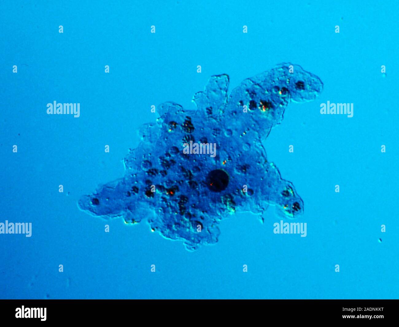 Amoeba. Interference contrast light micrograph of the large protozoan amoeba, Amoeba proteus. An ...