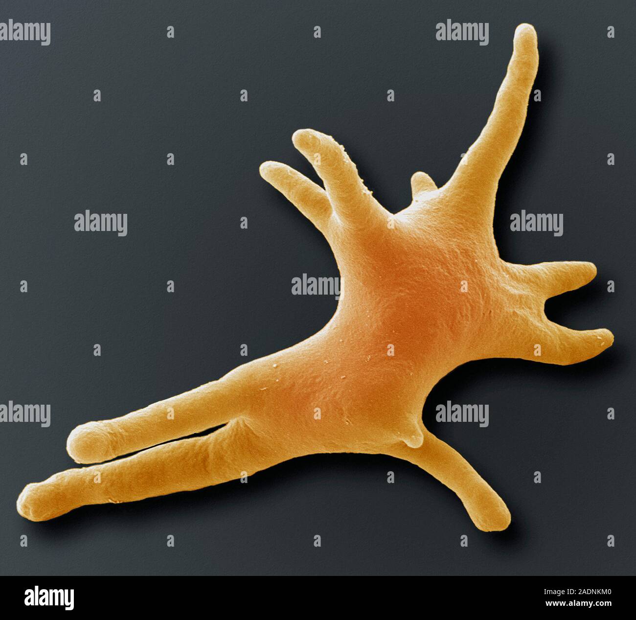 Amoeba. Coloured scanning electron micrograph (SEM) of an Amoeba proteus protozoan. This is a ...