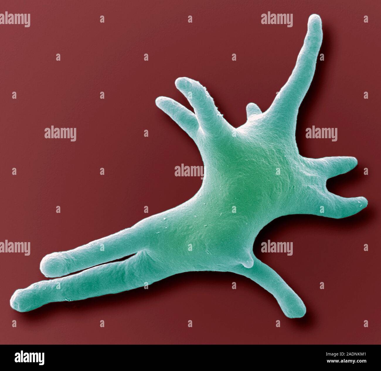 Amoeba. Coloured scanning electron micrograph (SEM) of an Amoeba ... Amoeba. Coloured scanning electron micrograph (SEM) of an Amoeba ...