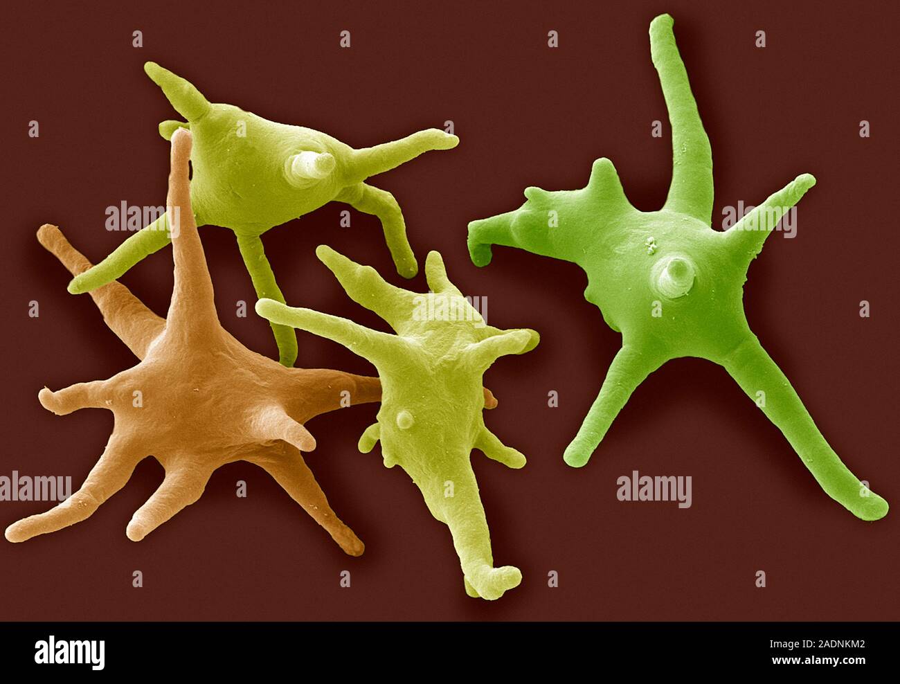 Amoeba. Coloured scanning electron micrograph (SEM) of four Amoeba proteus protozoa. These are ...