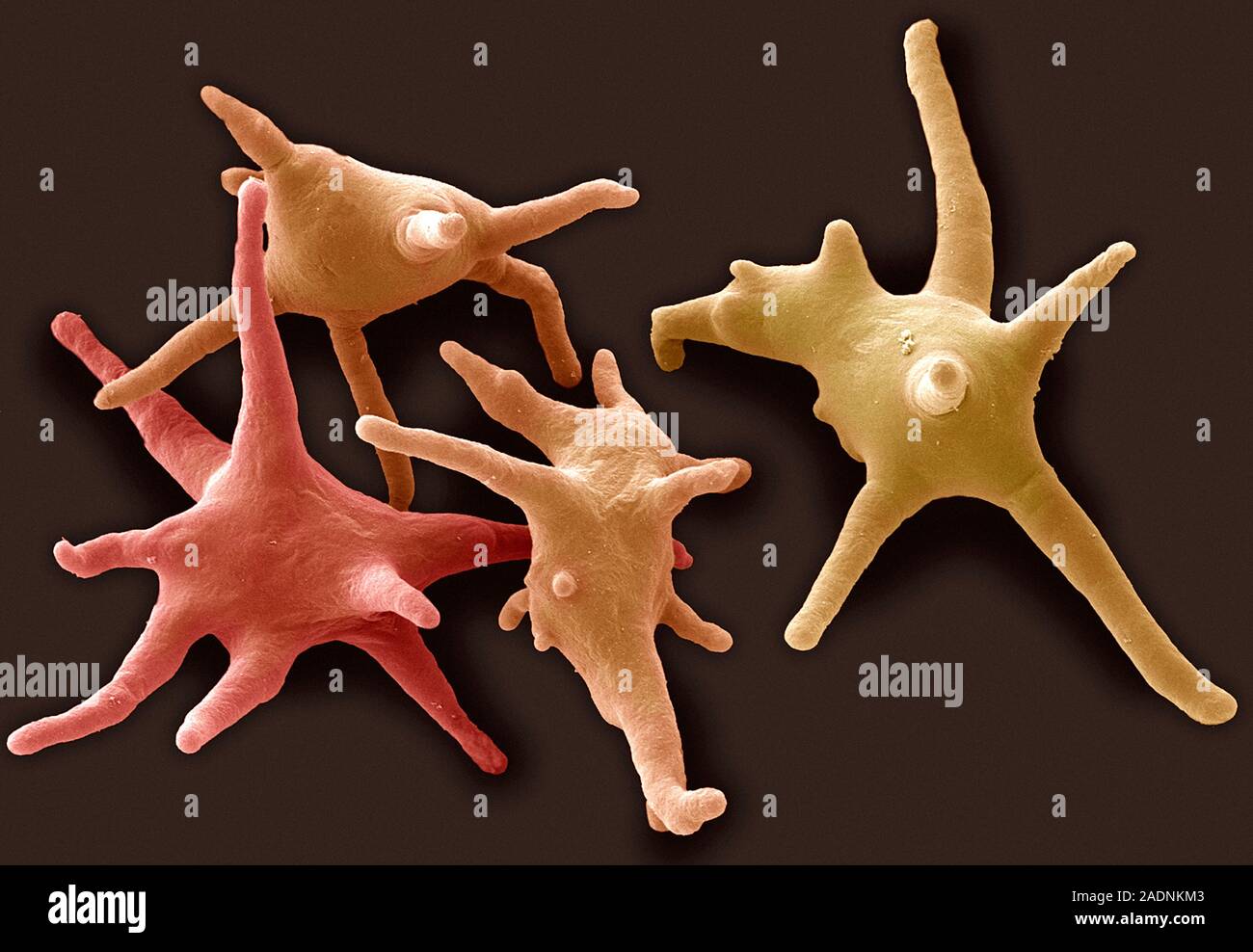 Amoeba. Coloured scanning electron micrograph (SEM) of four Amoeba ... Amoeba. Coloured scanning electron micrograph (SEM) of four Amoeba ...