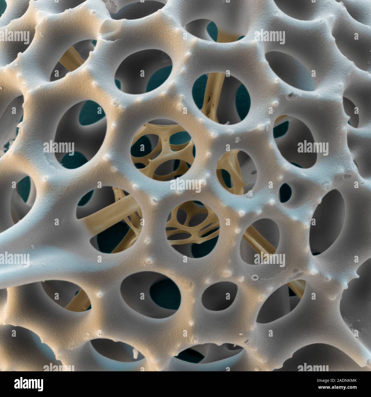 Spumellaria radiolarian. Coloured scanning electron micrograph (SEM) of the shell of a ...