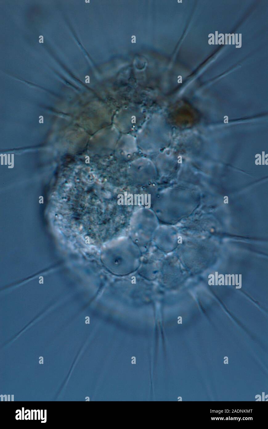 Amoeba. Light micrograph of an amoeba with many filopodia, thread-like ...