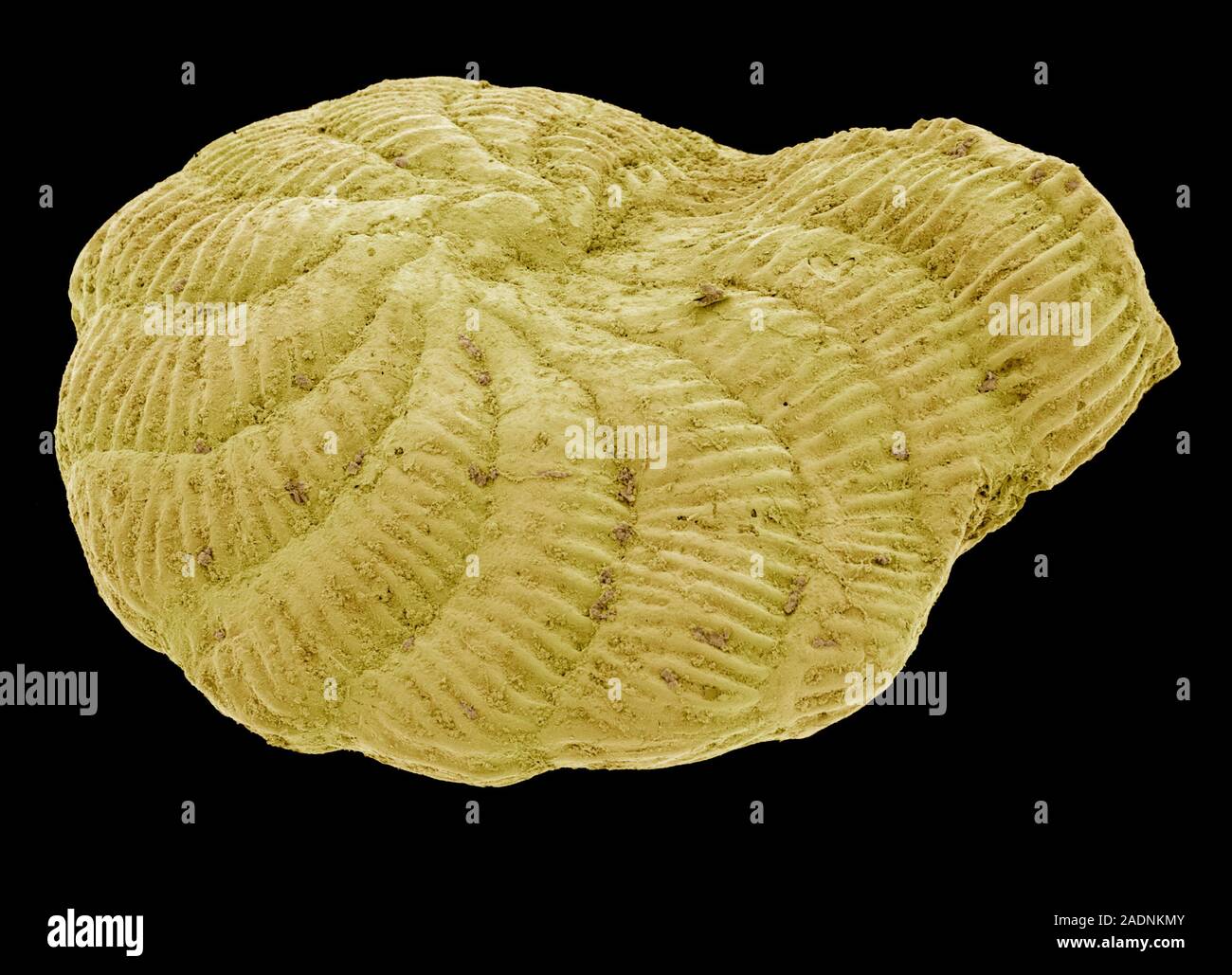 Foraminiferan. Coloured scanning electron micrograph (SEM) of a ...
