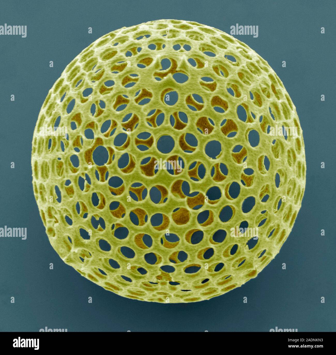 Acrosphaera radiolarian. Coloured scanning electron micrograph (SEM) of ... Acrosphaera radiolarian. Coloured scanning electron micrograph (SEM) of ...