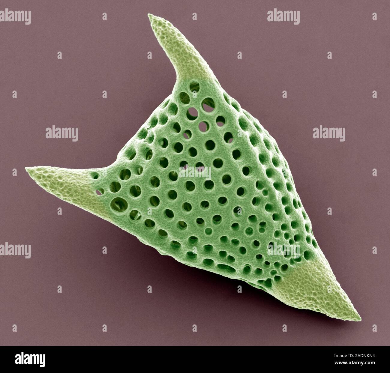 Lychnocanium radiolarian. Coloured scanning electron micrograph (SEM ... Lychnocanium radiolarian. Coloured scanning electron micrograph (SEM ...