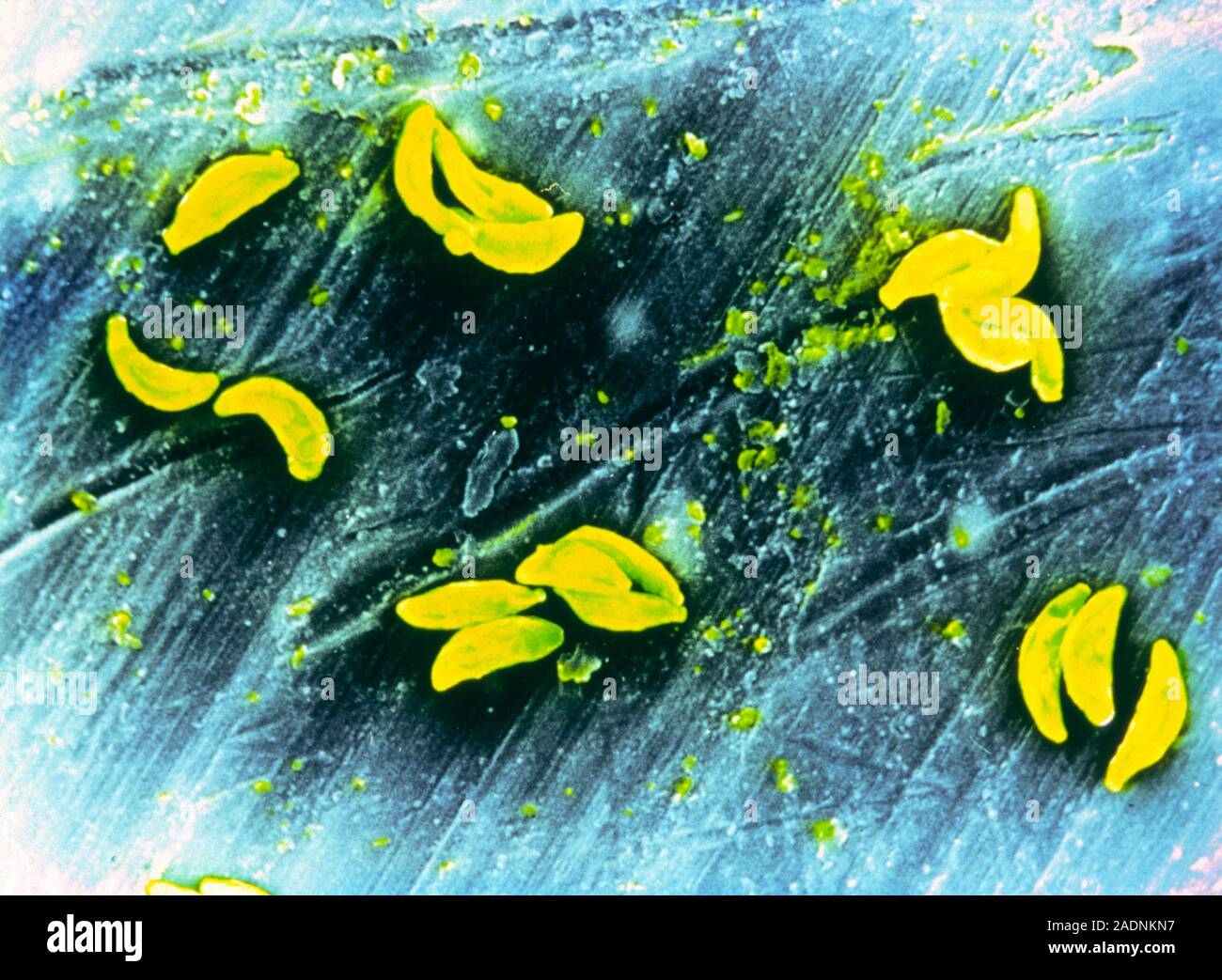 False-colour scanning electron micrograph (SEM) of individual ...