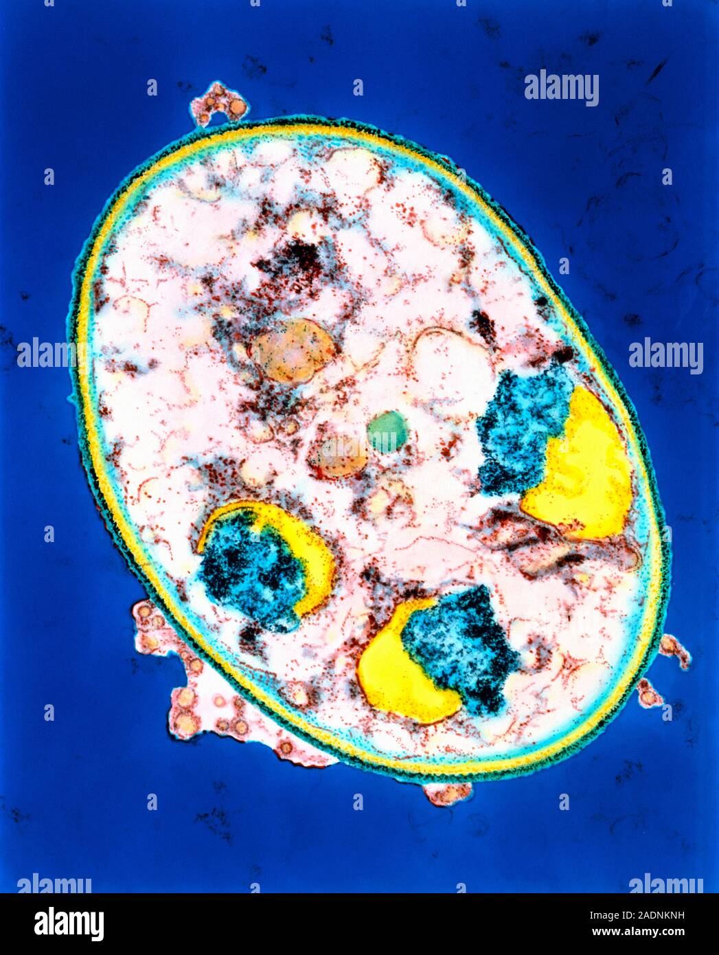 Pneumocystis carinii cyst. Coloured transmission electron mMicrograph ...
