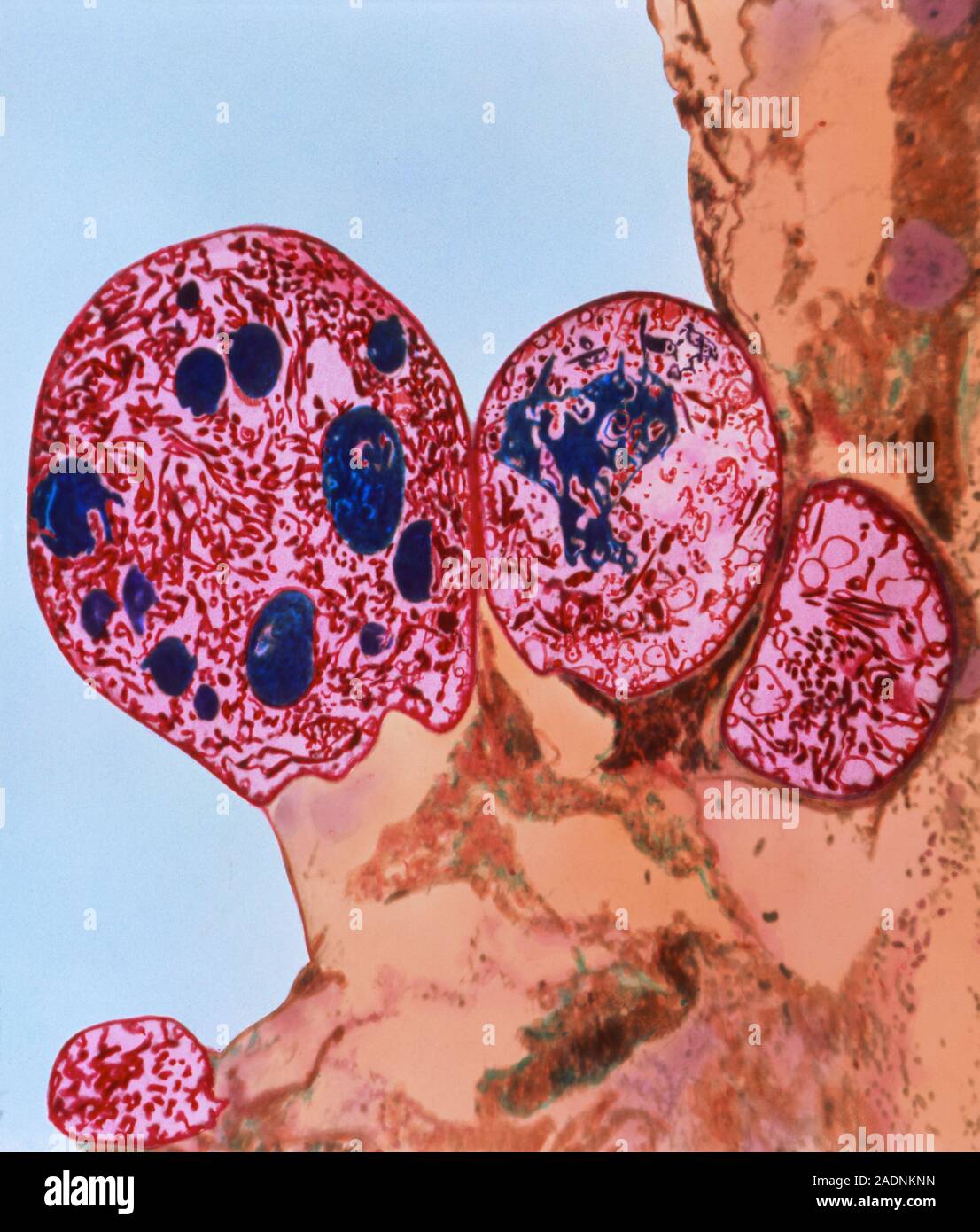 Malaria parasites. Coloured Transmission Electron Micrograph (TEM) of ...