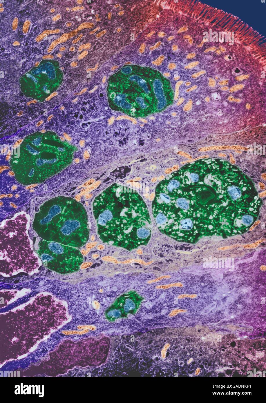 Protozoan spore formation. Coloured transmission electron micrograph ...