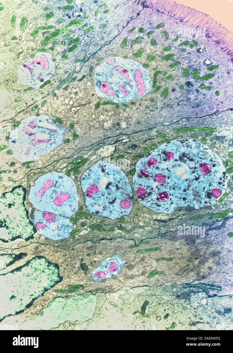 Protozoan spore formation. Coloured transmission electron micrograph ...