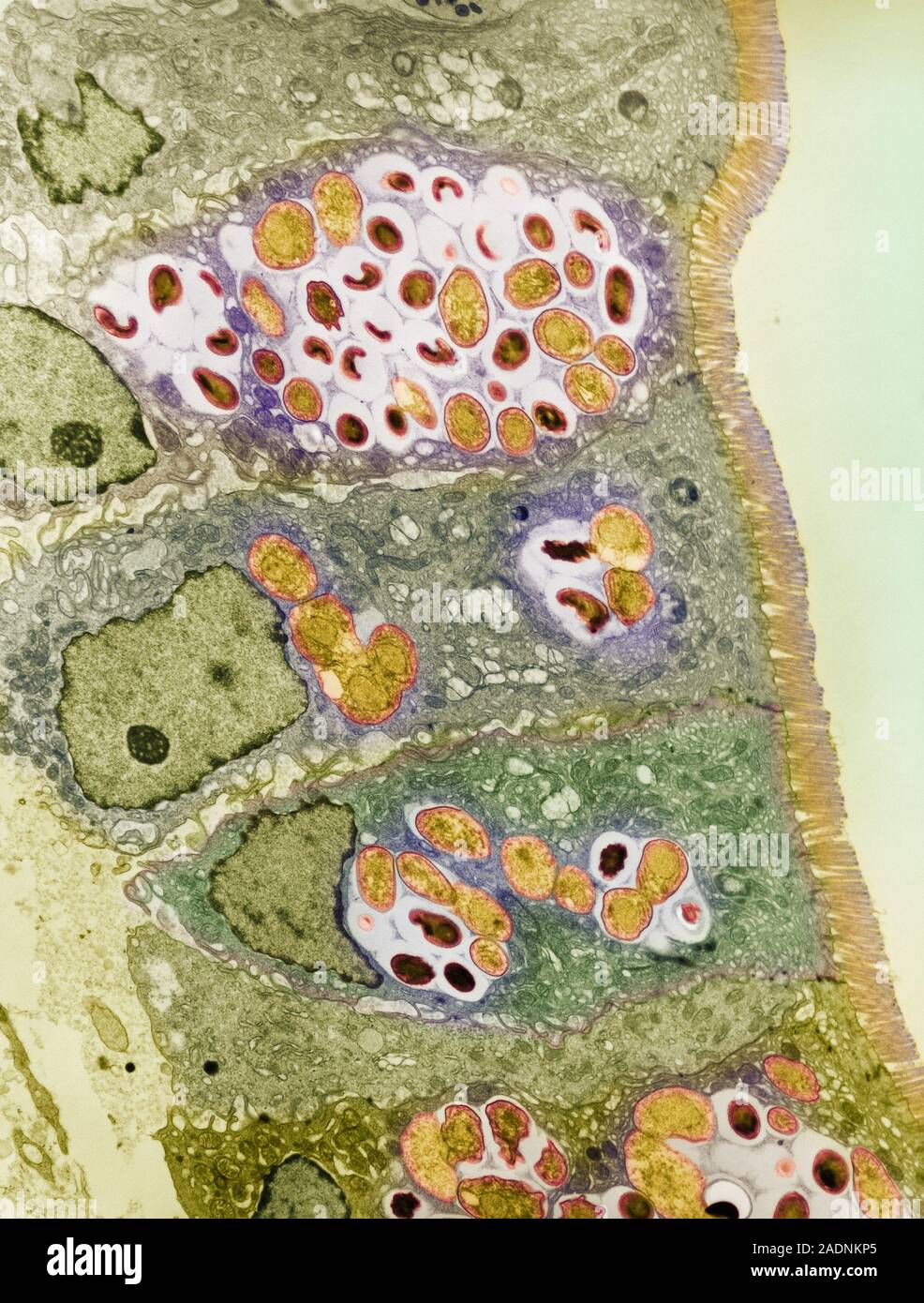 Protozoan spore formation. Coloured transmission electron micrograph ...