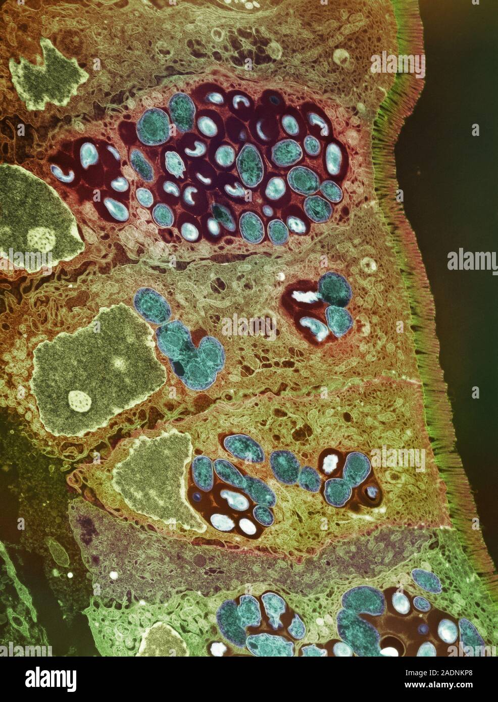 Protozoan spore formation. Coloured transmission electron micrograph ...