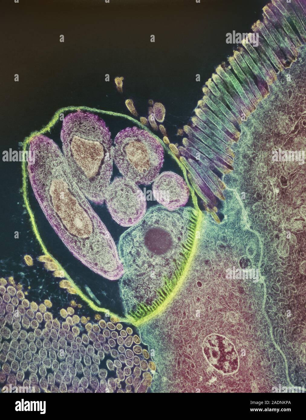 Cryptosporidium protozoa. Coloured transmission electron micrograph ...