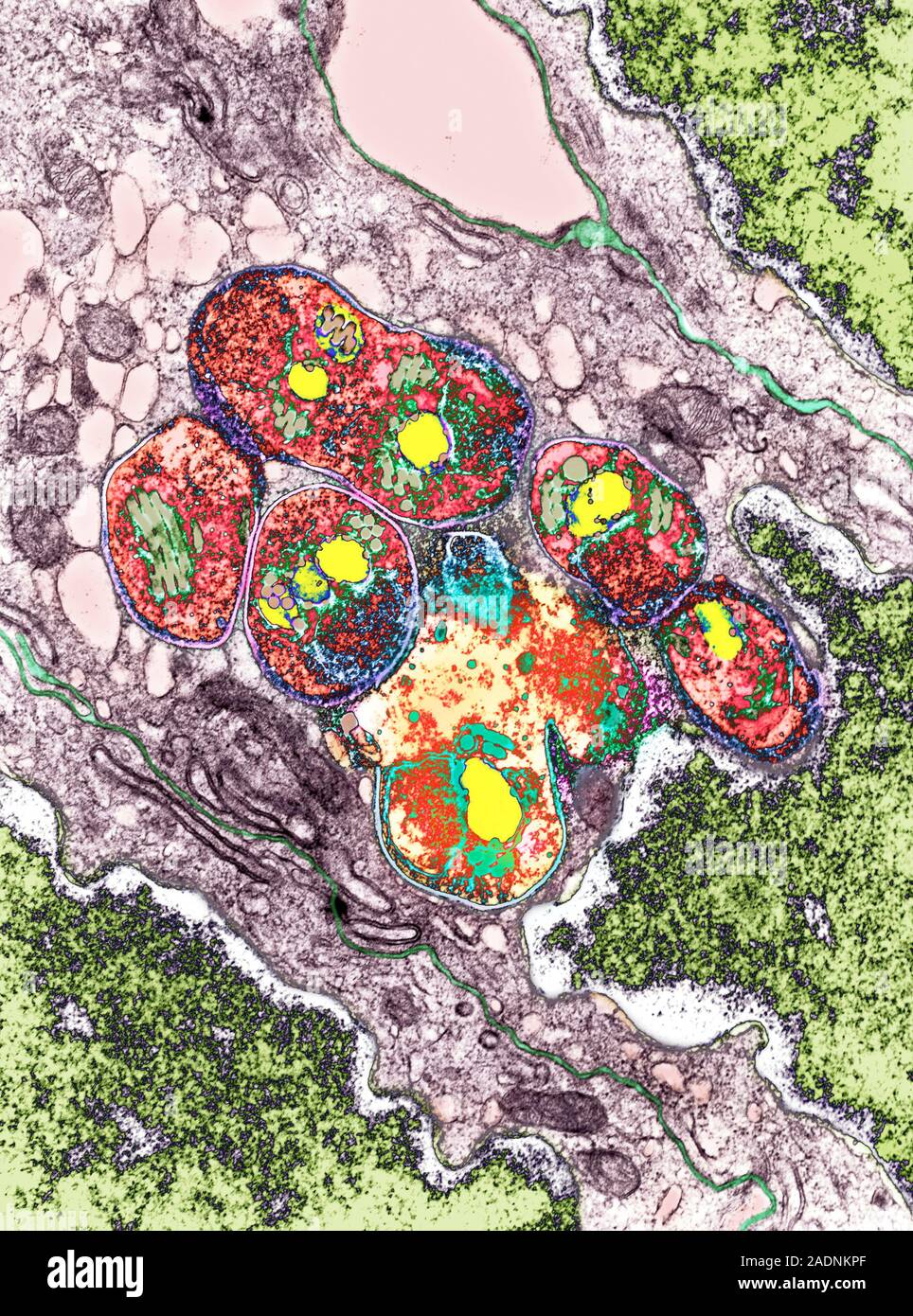 Intestinal Protozoan Parasites In Cell Coloured Transmission Electron Micrograph Tem Of