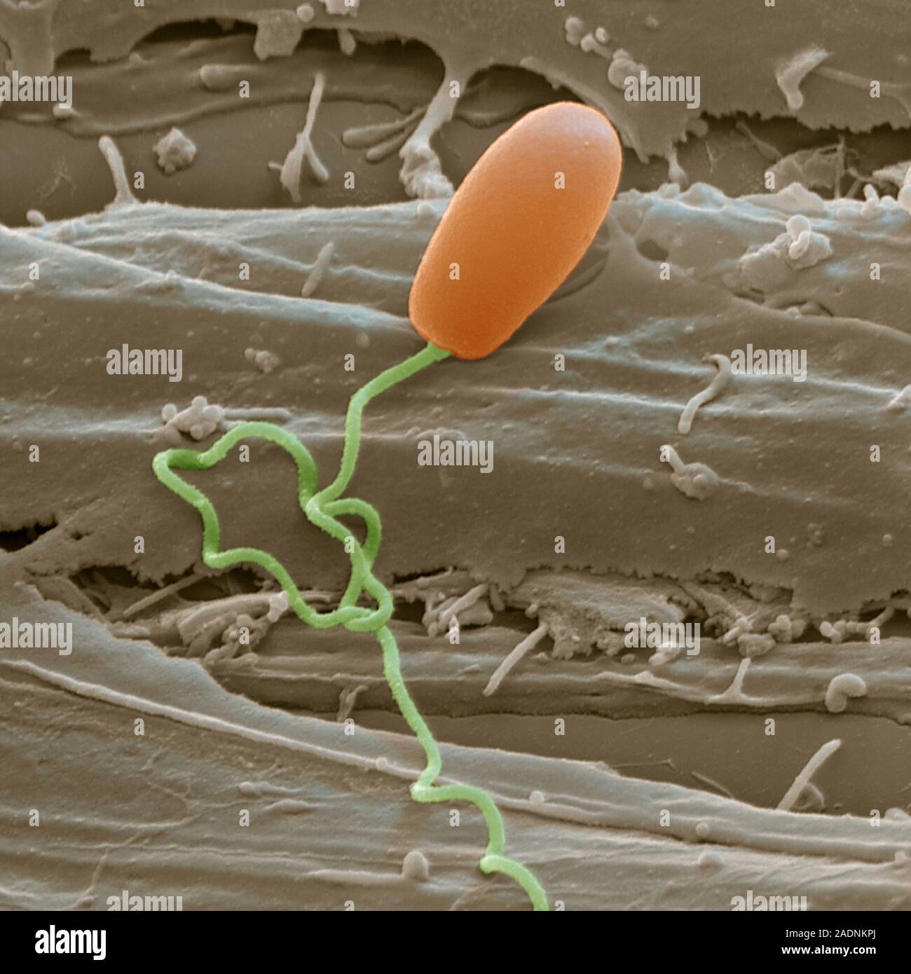 Microsporidium parasite. Coloured scanning electron micrograph (SEM) of ...