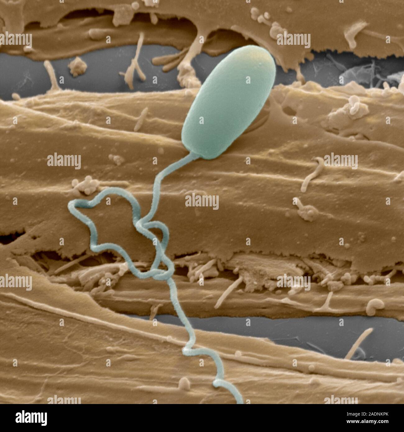 Parasite spore. Coloured scanning electron micrograph (SEM) of a ...