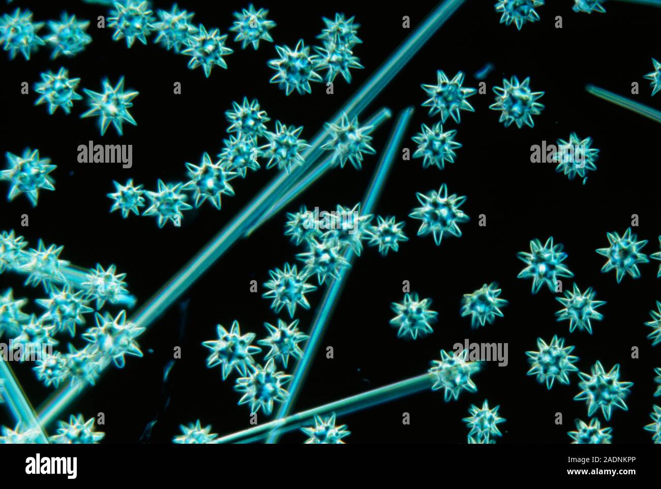 Light micrograph showing spicules of a sponge (Porifera). This phylum ...