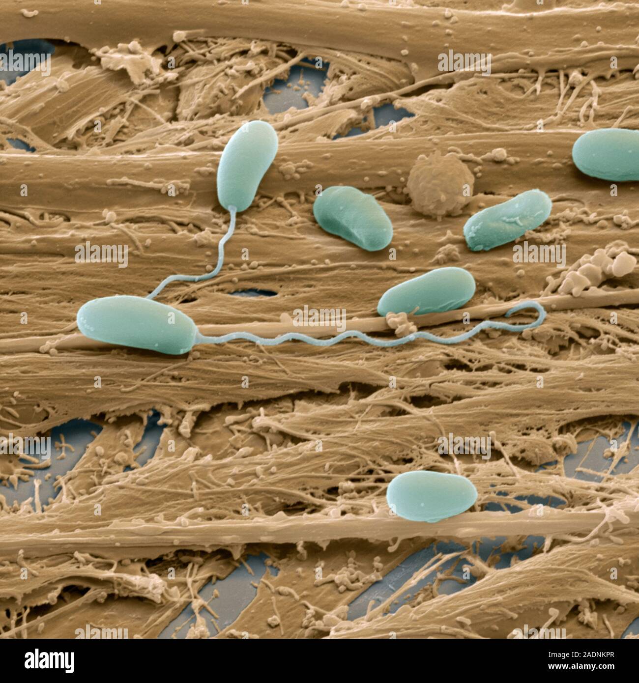 Parasite spores. Coloured scanning electron micrograph (SEM) of ...