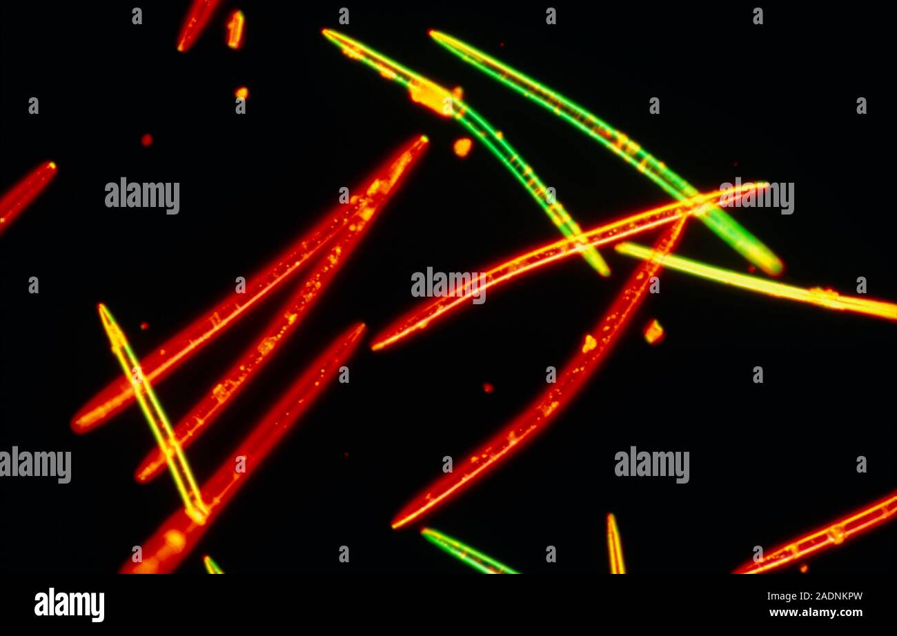 Light micrograph showing spicules of a sponge, Sycon coronatum. This ...