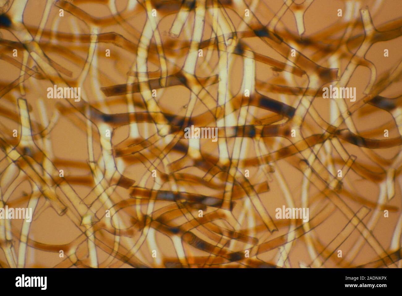 Polarised light micrograph showing spicules of a sponge, Sycon ...