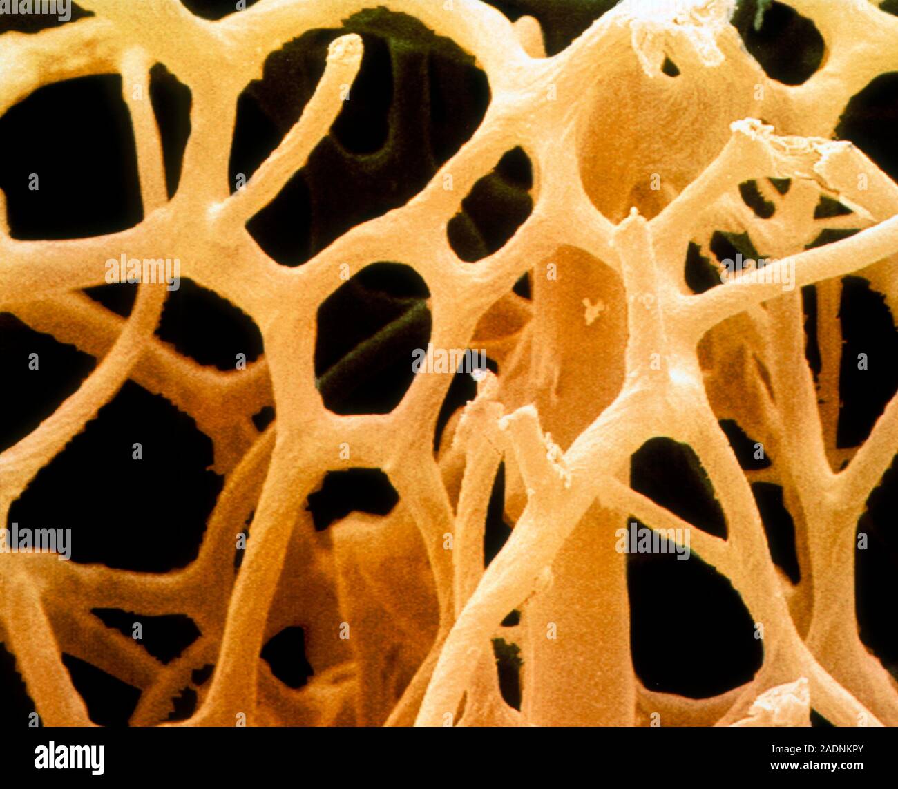 Sponge. Coloured scanning electron micrograph (SEM) of an unidentified ...