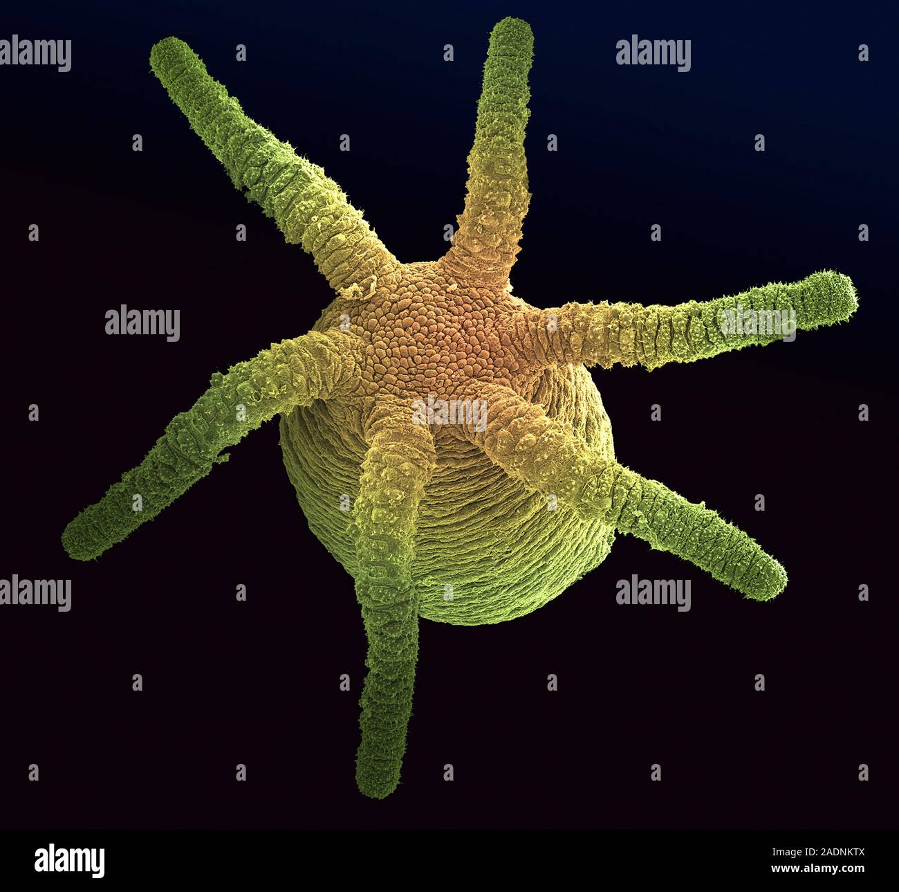Hydra. Coloured scanning electron micrograph (SEM) of Hydra sp., a ...