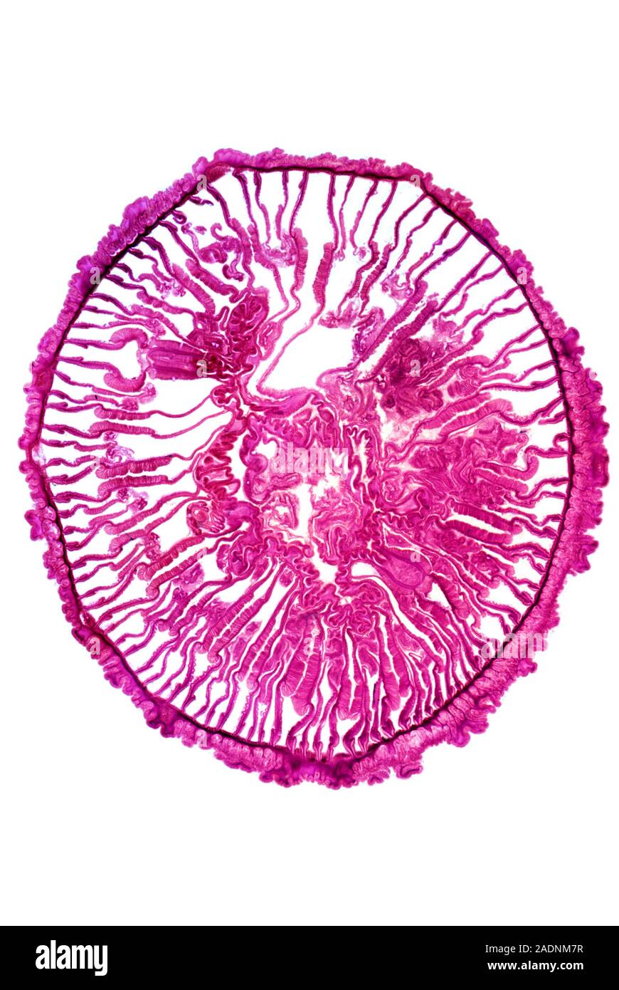 Gem anemone. Light micrograph of a transverse section through the body ...