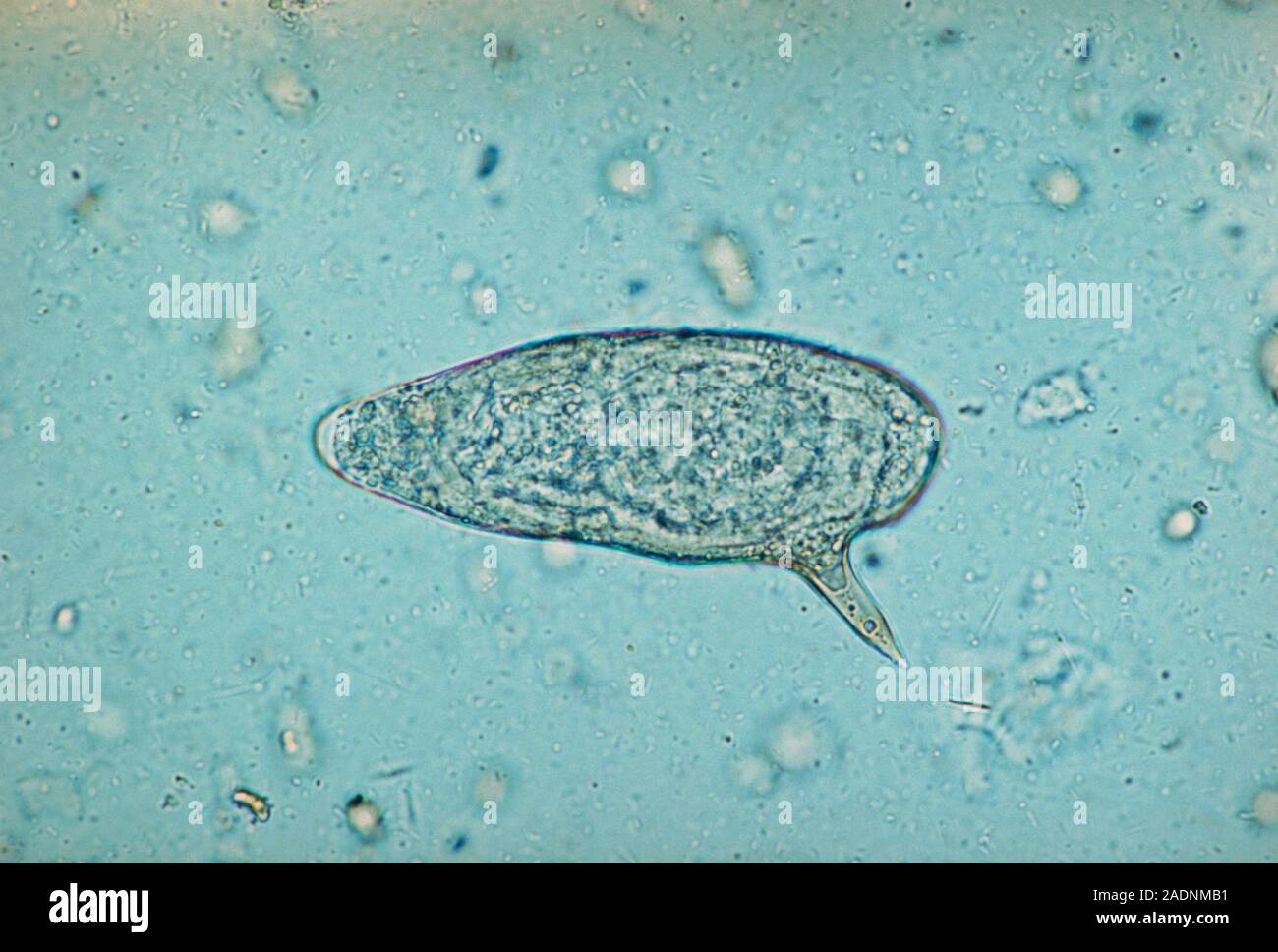 Light micrograph of the blood fluke Schistosoma mansoni, showing the ...