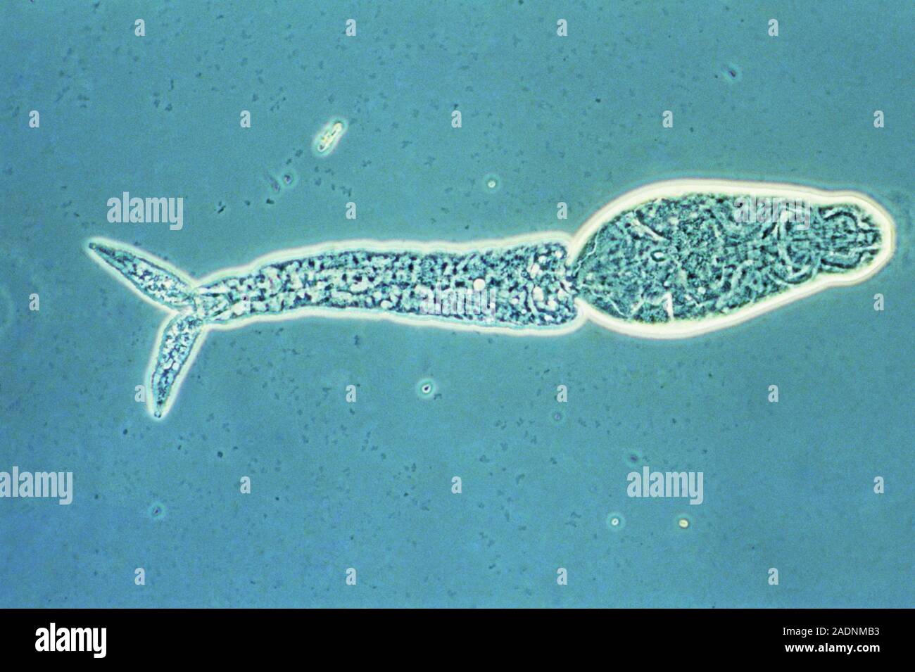 Light micrograph of a cercarial larva (final & most infective stage) of ...
