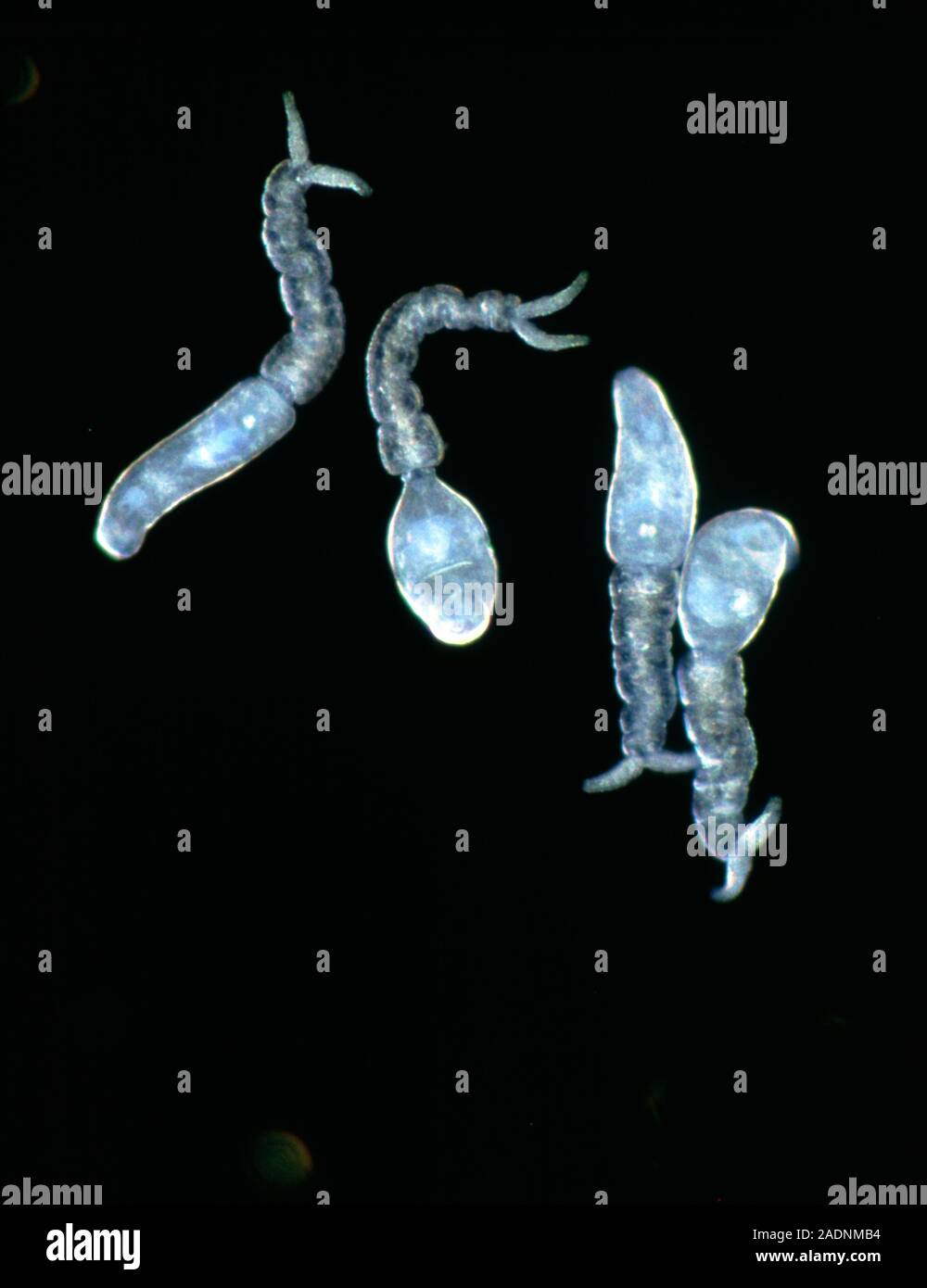 Light micrograph of cercariae larvae (final & most infective stage) of ...