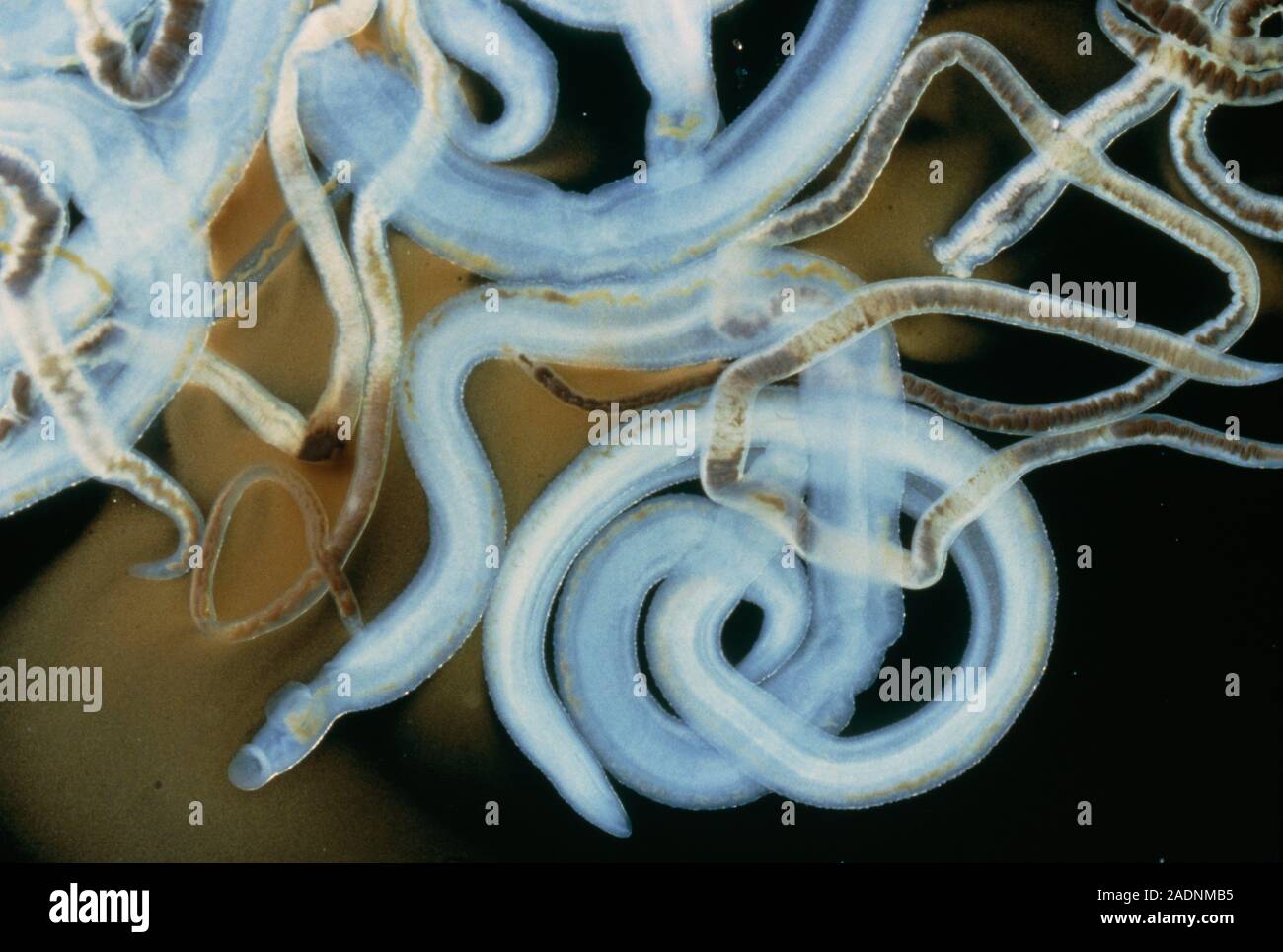 Light micrograph of adult intestinal blood flukes, Schistosoma mansoni ...