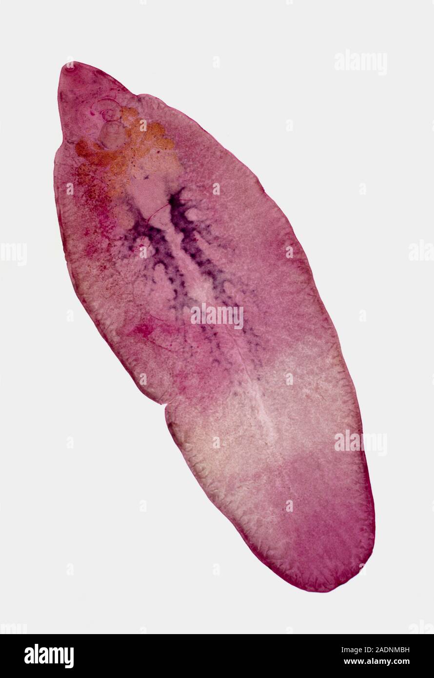 Light micrograph of a giant liver fluke, Fasciola hepatica, a parasite ...
