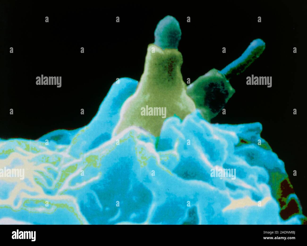 Bilharzia fluke. Coloured Scanning Electron Micro- graph (SEM) of an ...